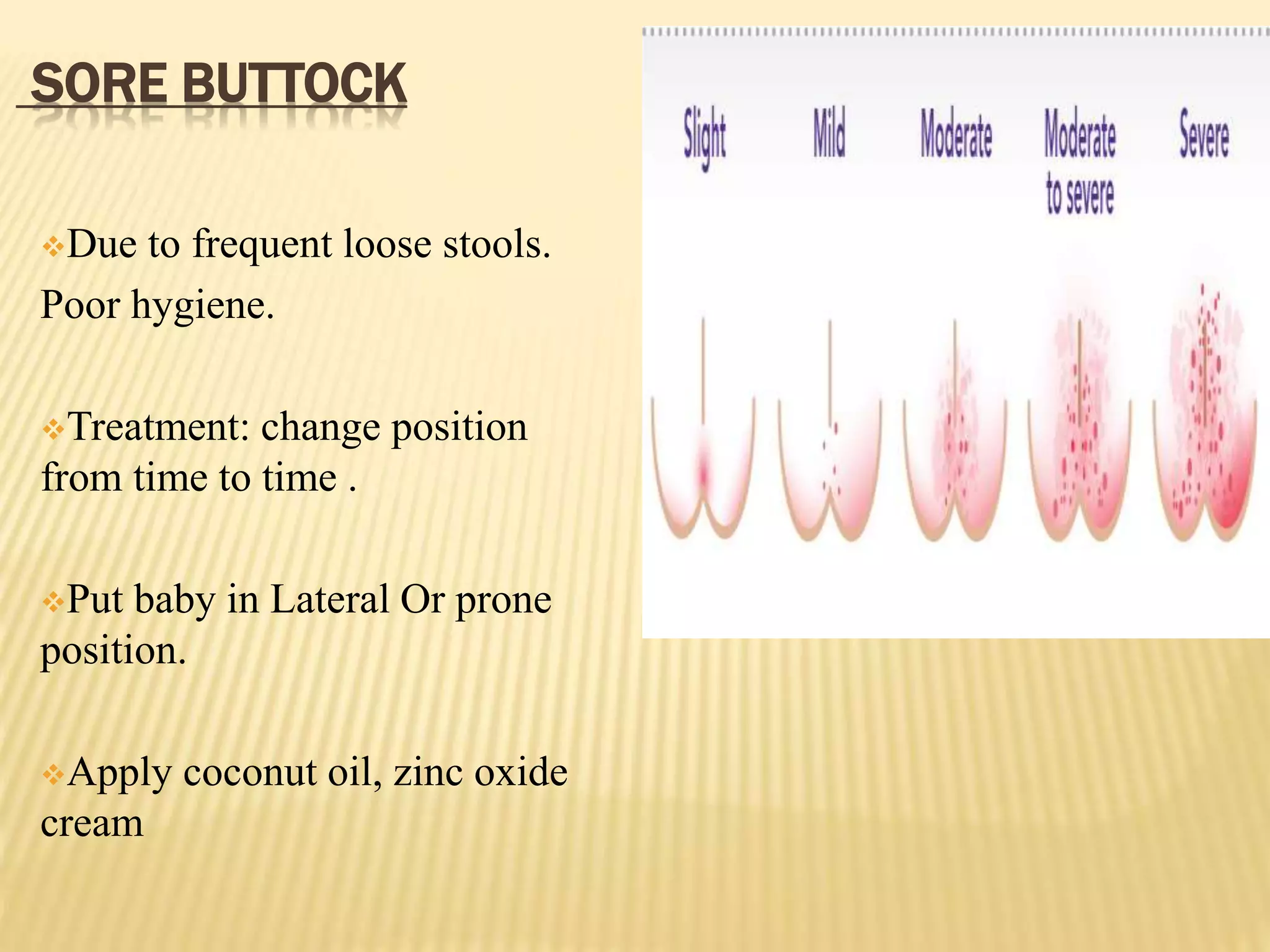 Office practice in neonatology BY DR.PRITESH B PATEL | PPTX