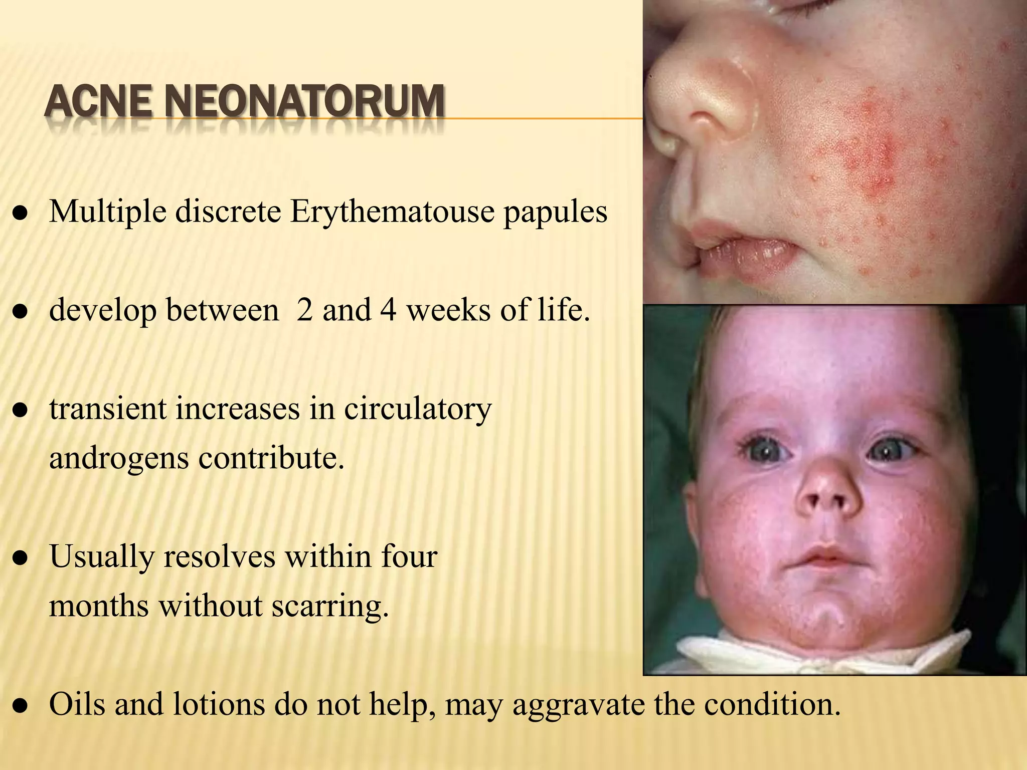 Office practice in neonatology BY DR.PRITESH B PATEL | PPTX