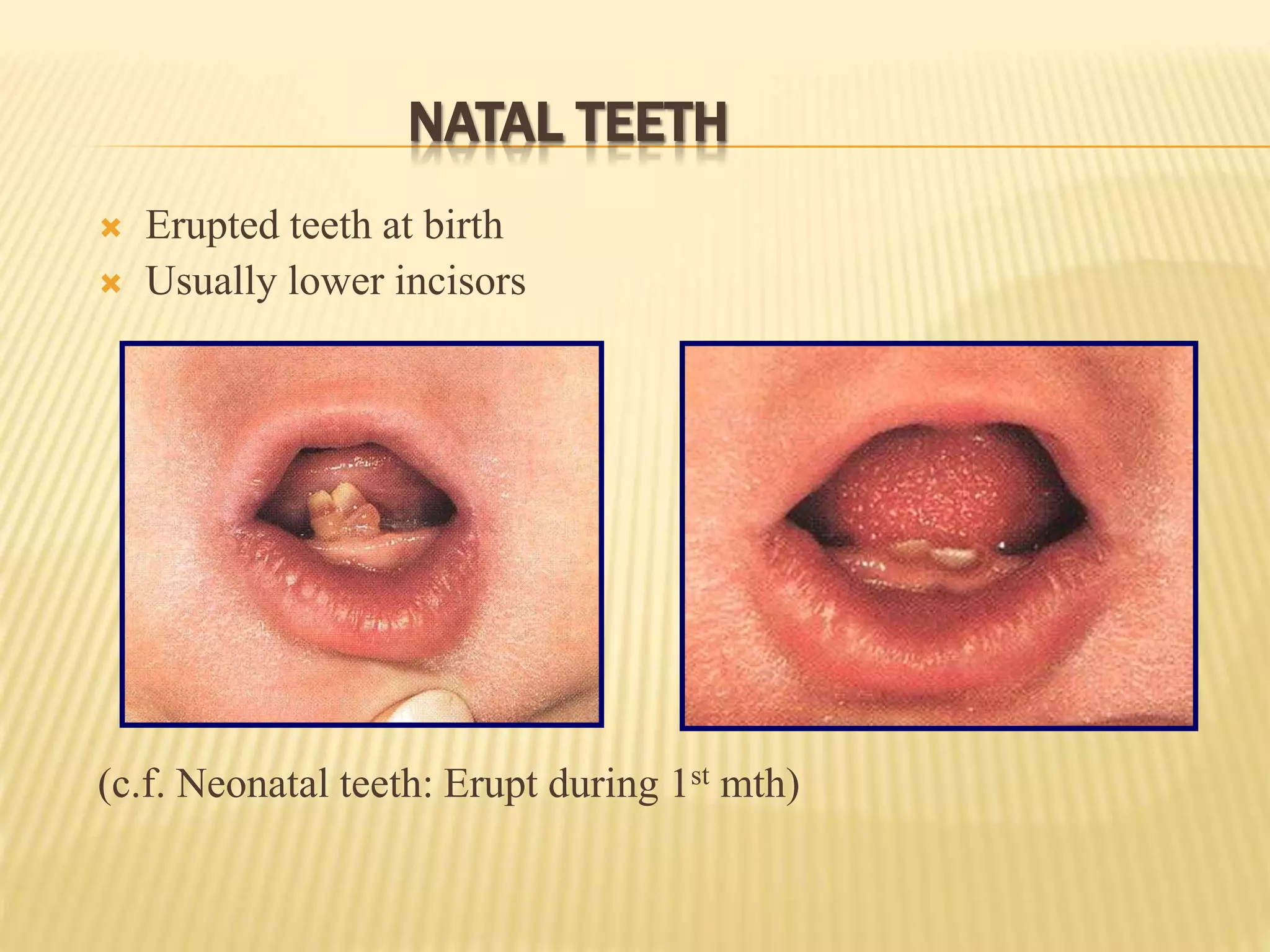 Office practice in neonatology BY DR.PRITESH B PATEL | PPTX