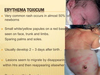Office practice in neonatology BY DR.PRITESH B PATEL | PPTX