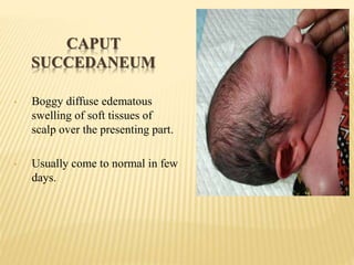 Office practice in neonatology BY DR.PRITESH B PATEL | PPTX