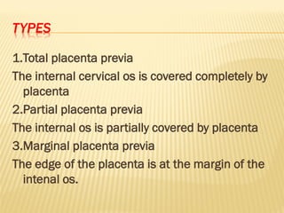 Placenta previa | PDF