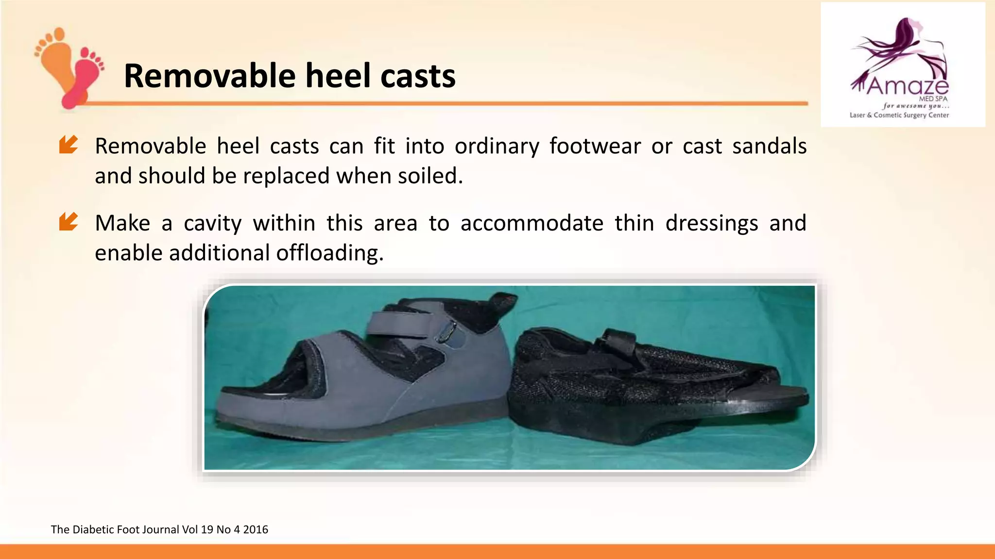 Offloading in diabetic foot | PPTX