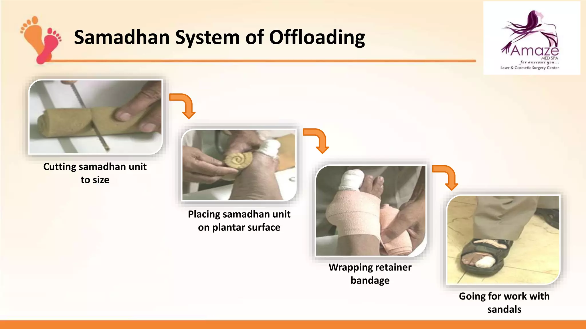 Offloading in diabetic foot | PPTX
