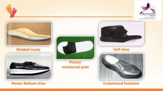 Offloading in diabetic foot | PPTX