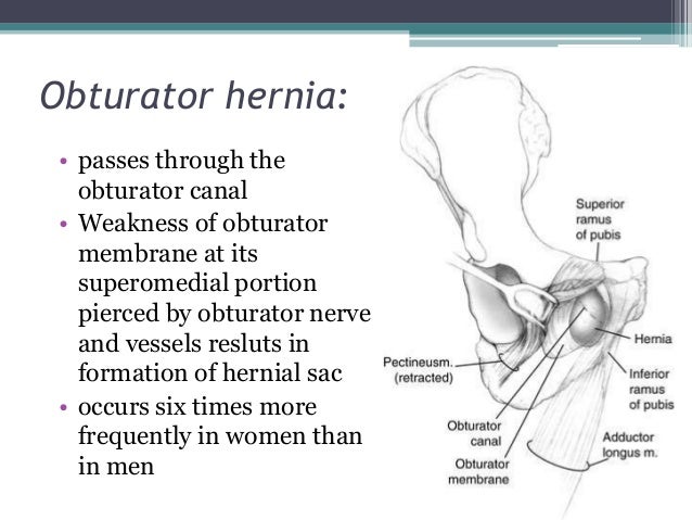 Ventral hernias