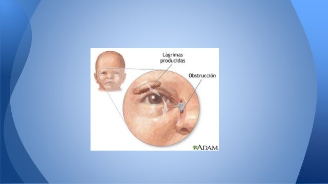 Patología vía lagrimal y exoftalmos.