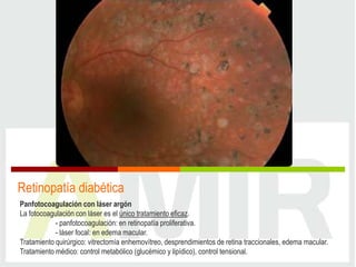 Repaso imágenes. Oftalmología. Patología de la retina. | PPTX