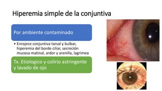 Oftalmologia Patologia de la Conjuntiva.pdf