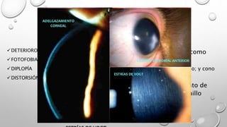 Retinopatía del Prematuro ROP-Oftalmopediatría | PPTX