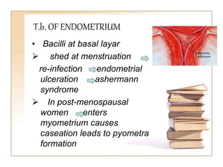 Obstetrics and gynaecological aspects of tb | PPTX