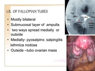 Obstetrics and gynaecological aspects of tb | PPTX