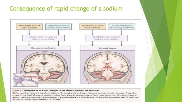 SODIUM HOMEOSTASIS | PPTX | Hormonal Disorders | Endocrine and ...
