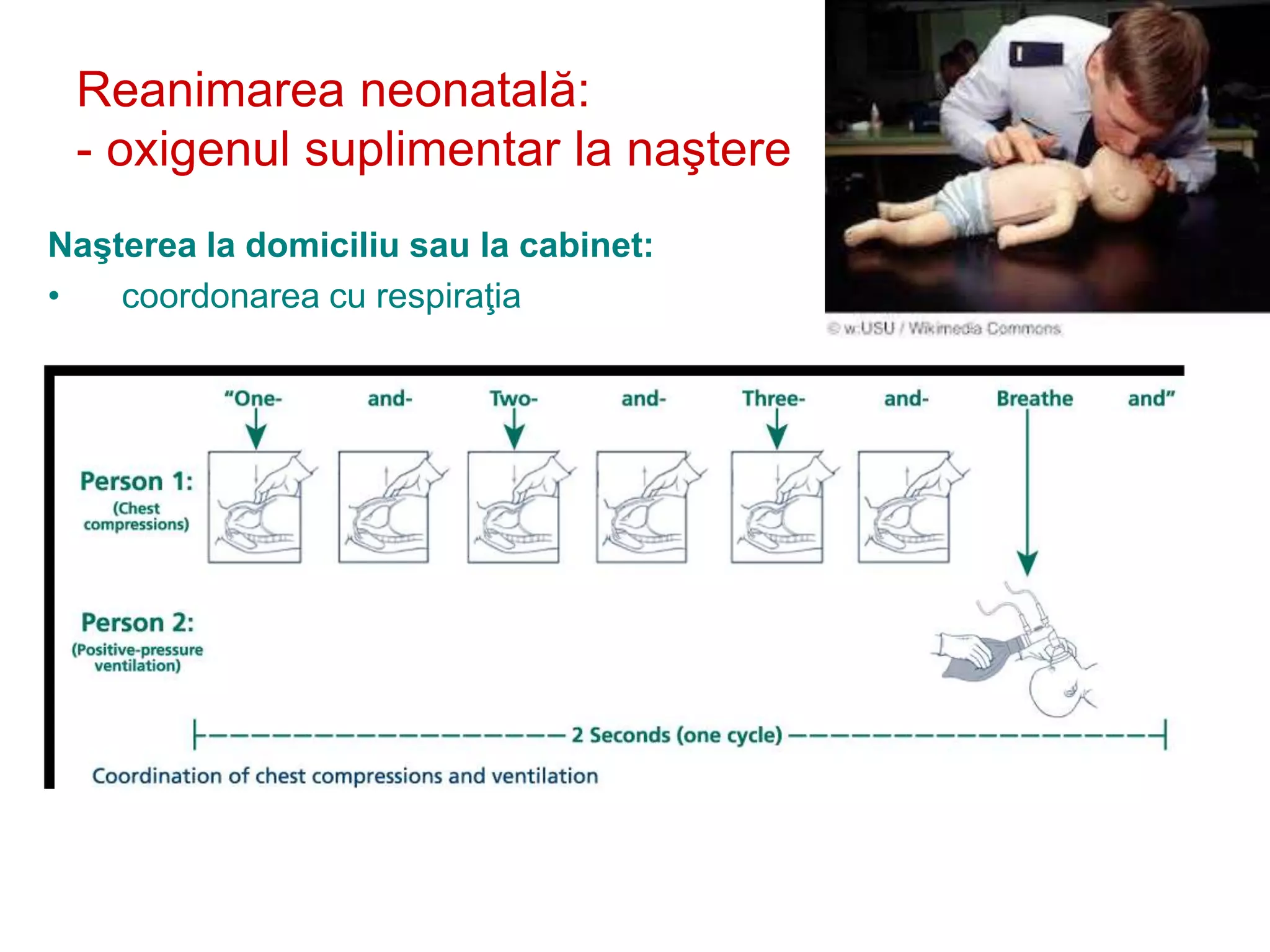 Ognean_Reanimarea neonatala Poiana BV.ppt