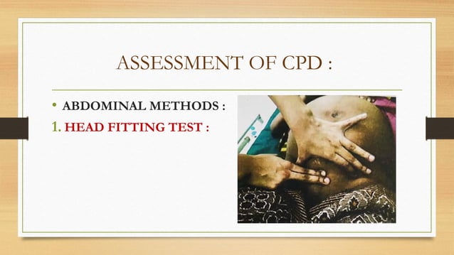 Cephalopelvic disproportion and it's management | PPTX