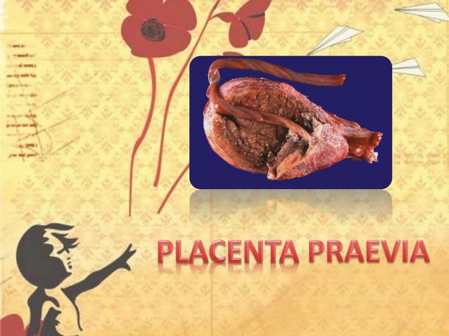 Placenta Praevia | PPTX | Pregnancy | Reproductive Health