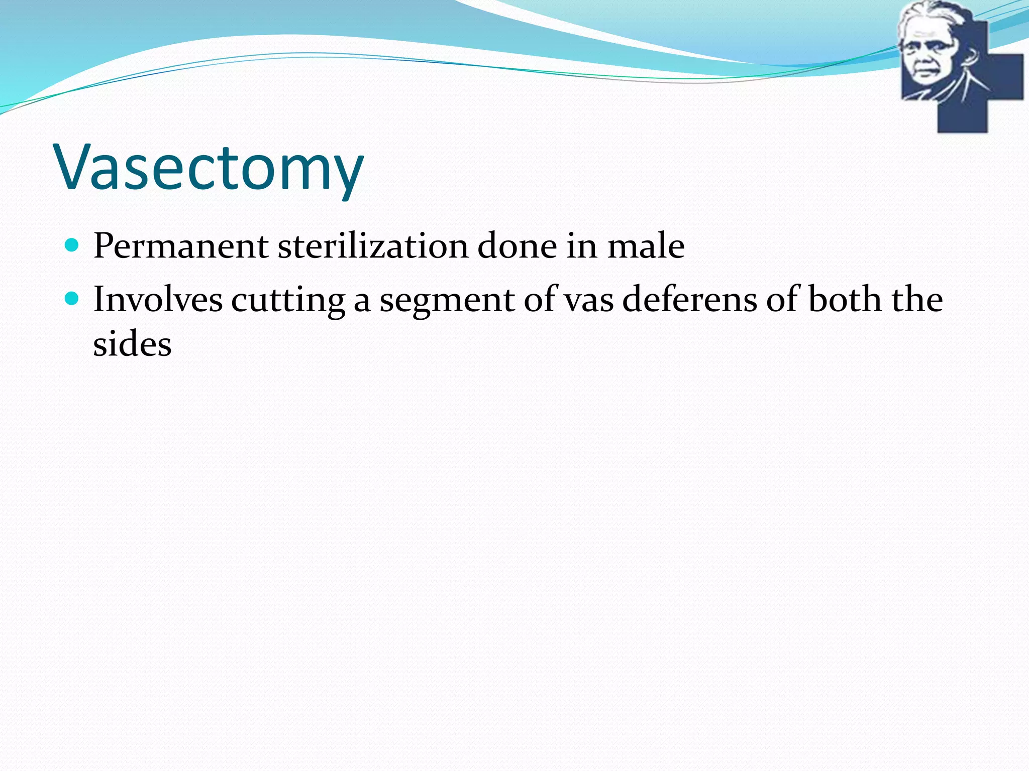 Vasectomy - Sterilization - No scalpel Vasectomy | PPTX