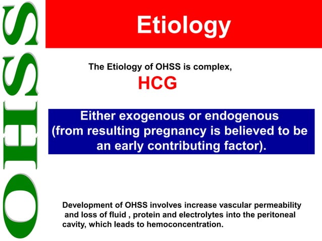 Medical Management of Ovarian Hyperstimulation Syndrome (OHSS) In 1500 ...