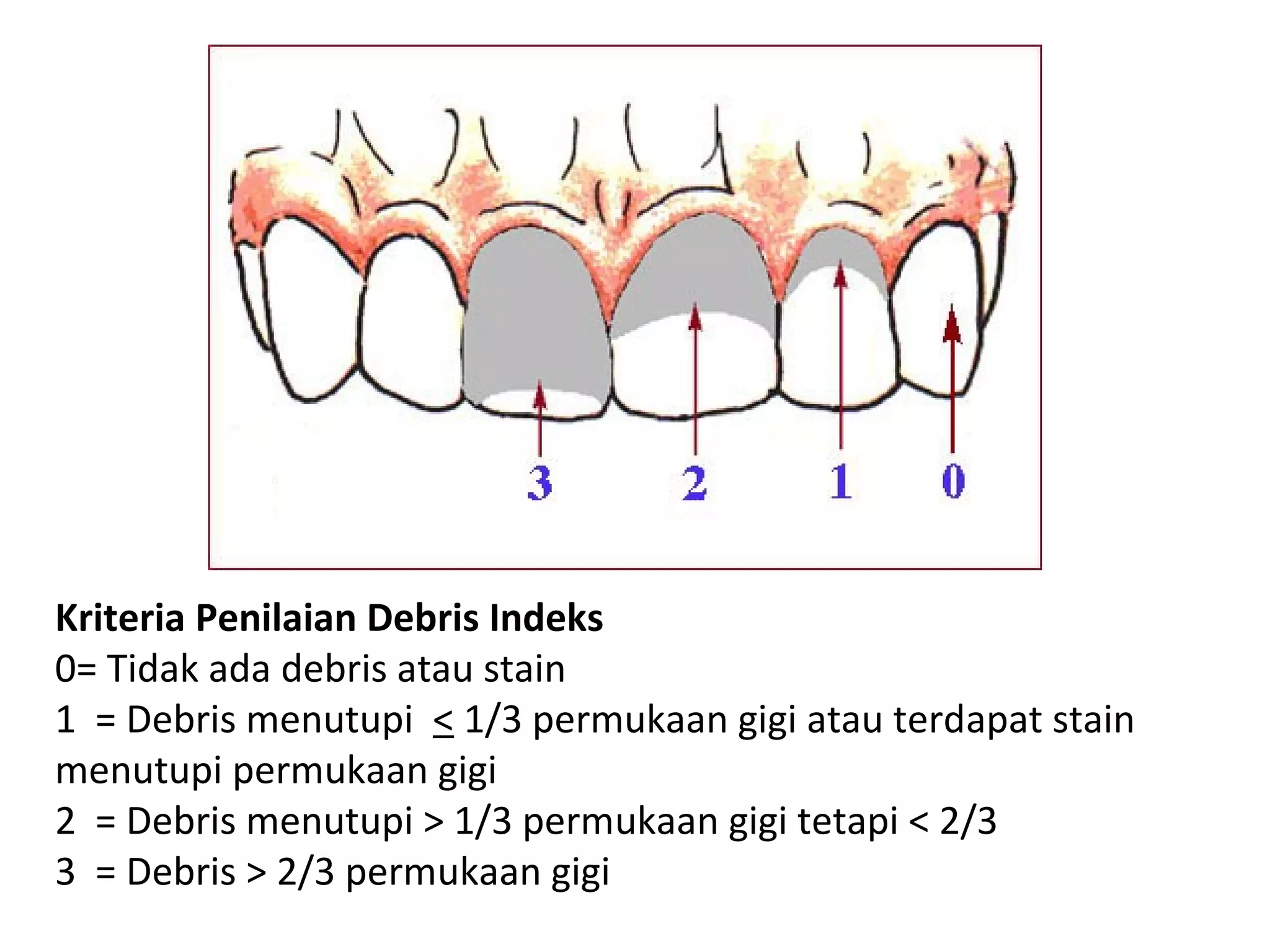 Ohi s | PPT