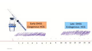 Ovarian hyperstimulation syndrome OHSS.pptx