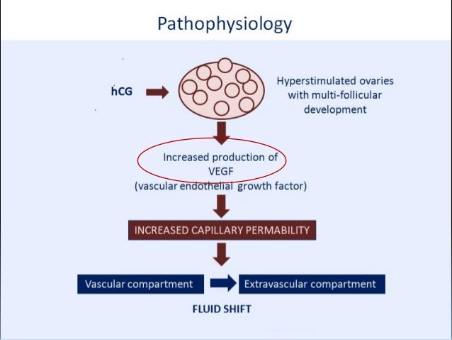 ROLE OF CABERGOLIN IN MANAGEMENT OF OHSS