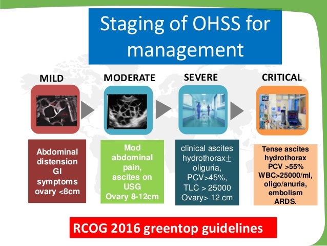 #Ohss #Prevention and #Treatment