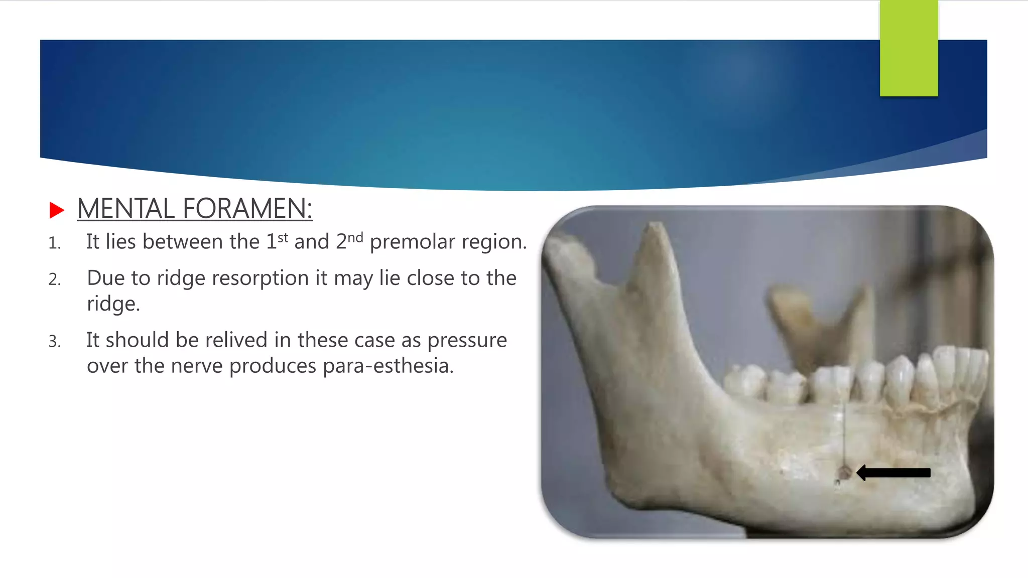 Anatomical landmarks of edentulous mandibular arch ppt (prosthodontics ...