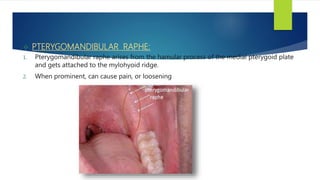 Anatomical landmarks of edentulous mandibular arch ppt (prosthodontics ...