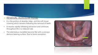 Anatomical landmarks of edentulous mandibular arch ppt (prosthodontics) easily understood | PPTX