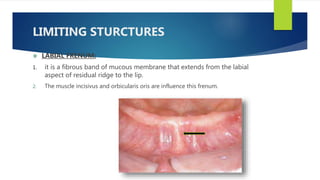 Anatomical landmarks of edentulous mandibular arch ppt (prosthodontics) easily understood | PPTX