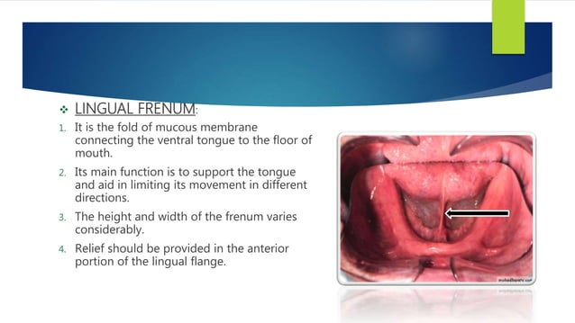 Anatomical landmarks of edentulous mandibular arch ppt (prosthodontics) easily understood | PPTX ...