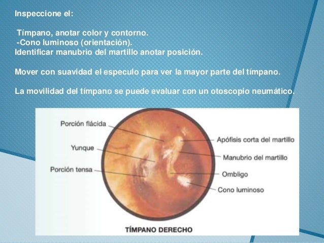 Exploración clínica de oído