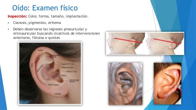Oido semiología