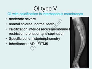 Seminar 22-11-2014 - Dr. A.M. Franken - Osteogenesis Imperfecta | PPT
