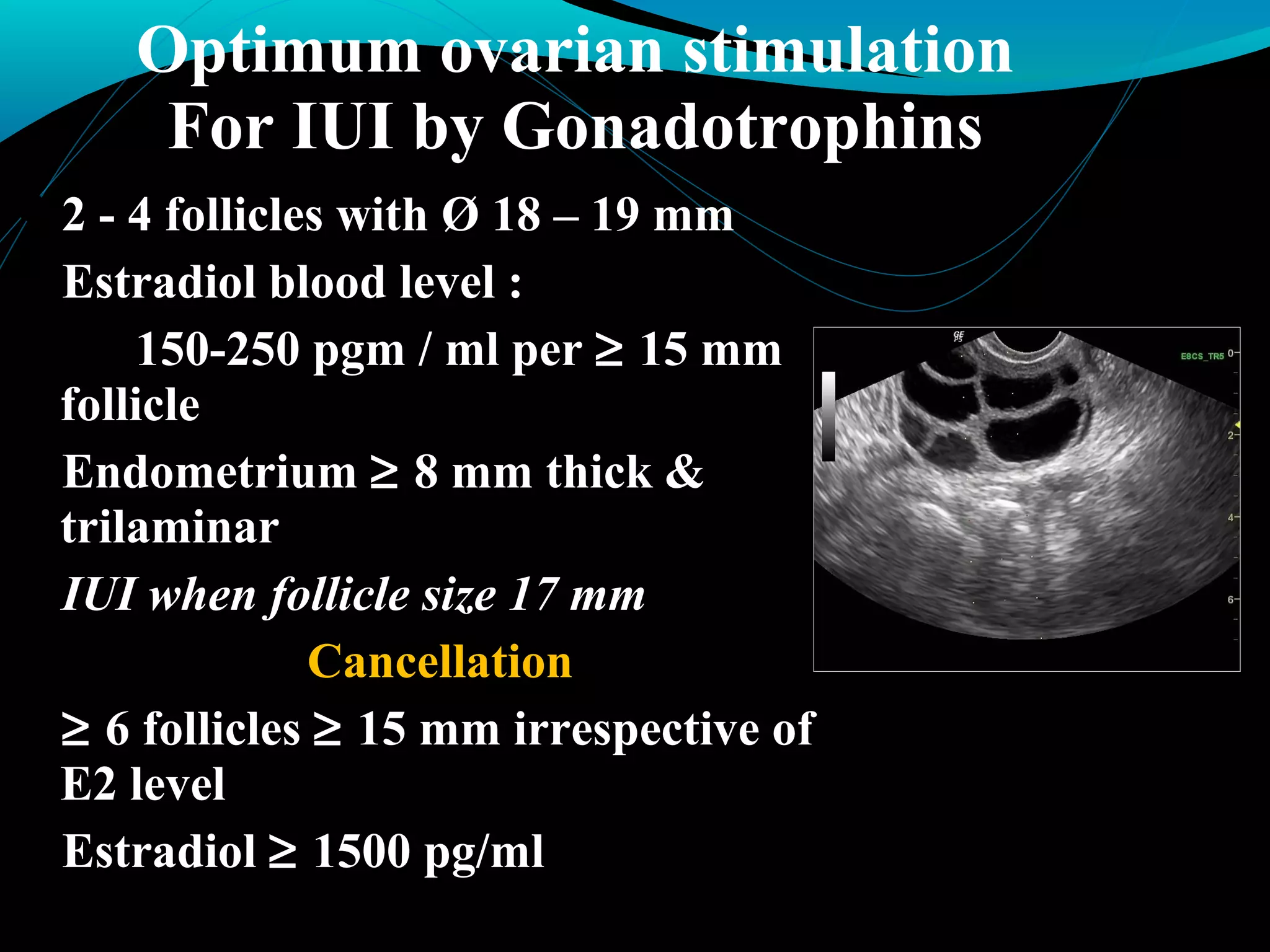 Ovulation induction in IUI | PPT