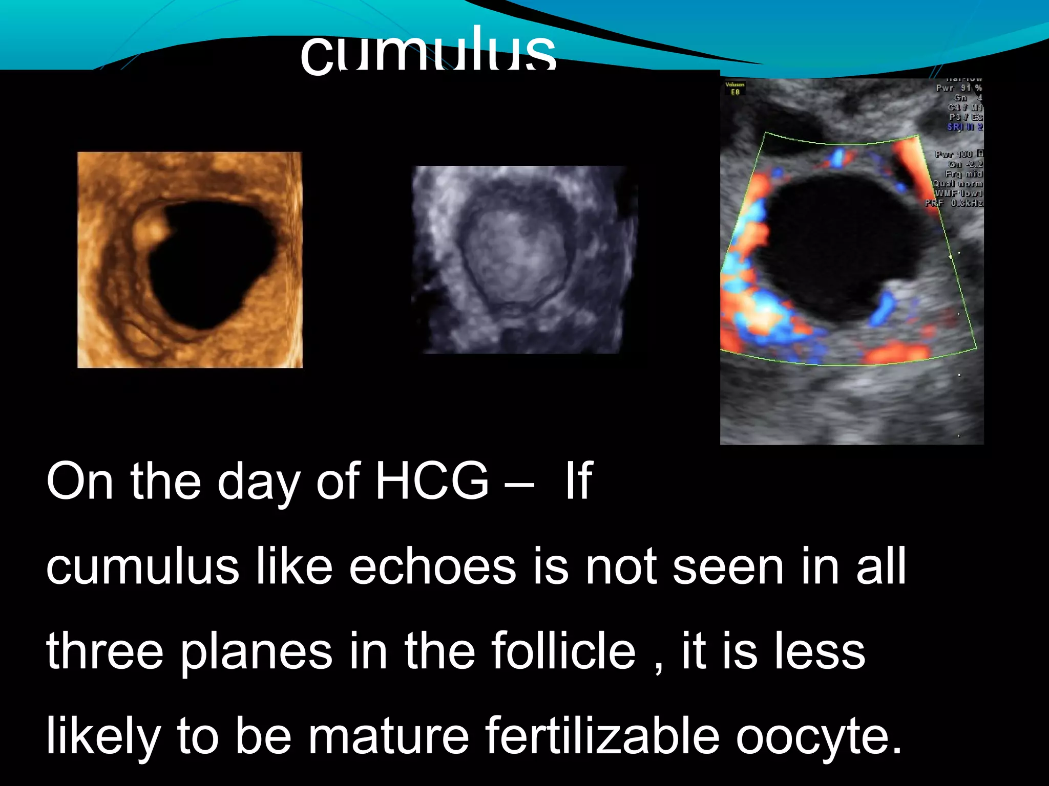 Ovulation induction in IUI | PPT