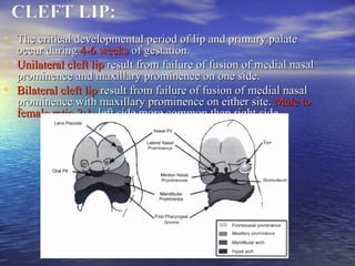 CLEFT LIP AND PALATE IN OMFS ADVANCED PPT | PPT