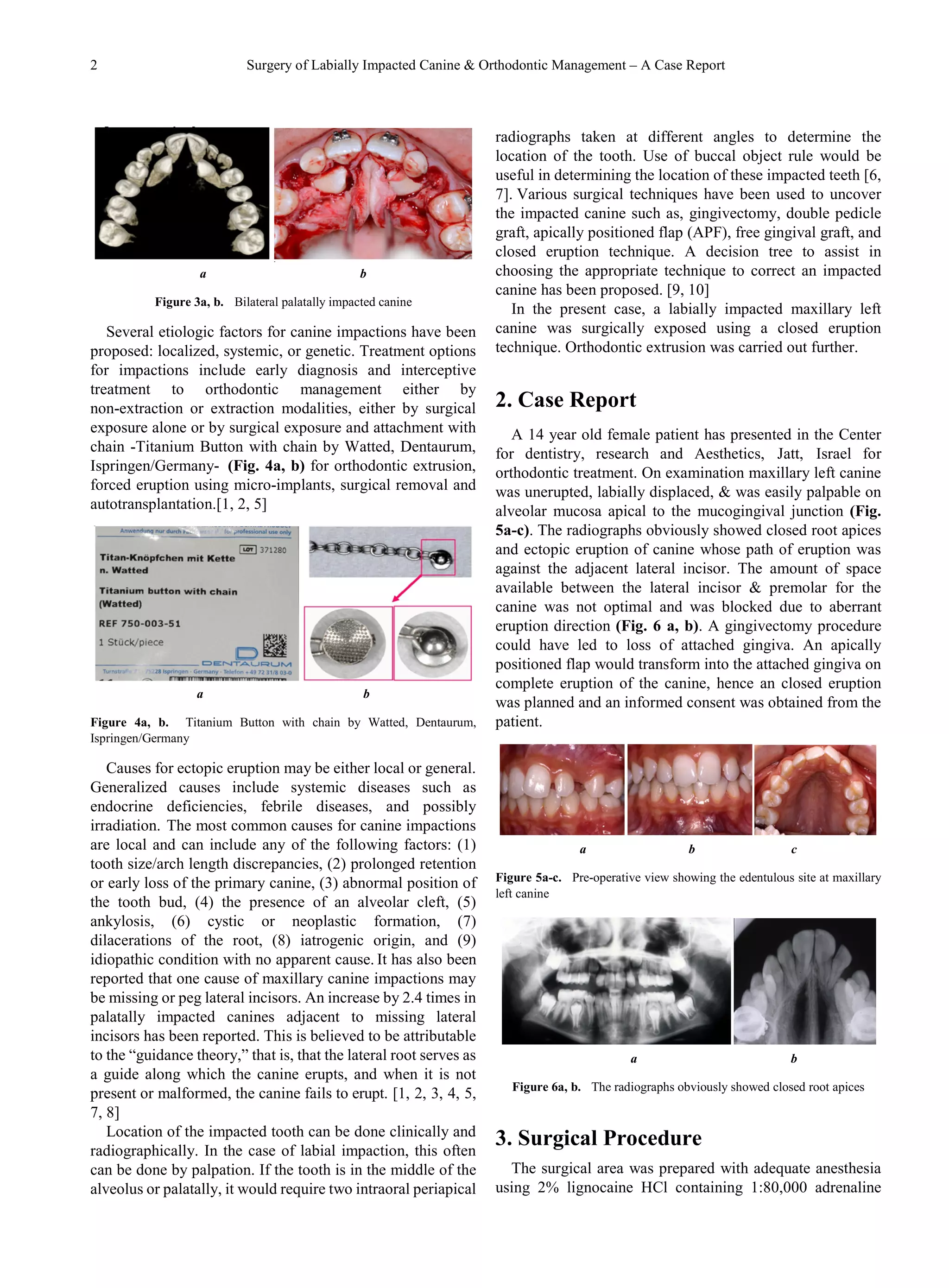 Surgery of Labially Impacted Canine & Orthodontic Management – A Case ...