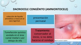 Enfermedades del Sistema Lagrimal | PPTX