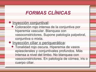 Ojo Rojo | PPT