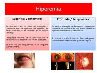 Ojo rojo | PPTX