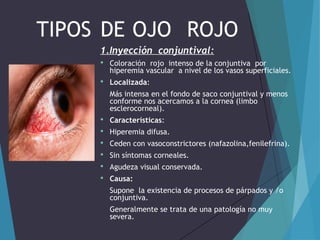 OJO ROJO - Clase de Oftalmología .ppt