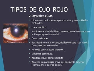 OJO ROJO - Clase de Oftalmología .ppt