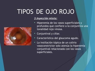OJO ROJO - Clase de Oftalmología .ppt