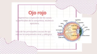 ojo rojo conjuntuvitiS OTRAS CAUSAS... (1).pptx