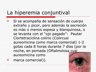 Ojo Rojo (Enfermería) | PPT