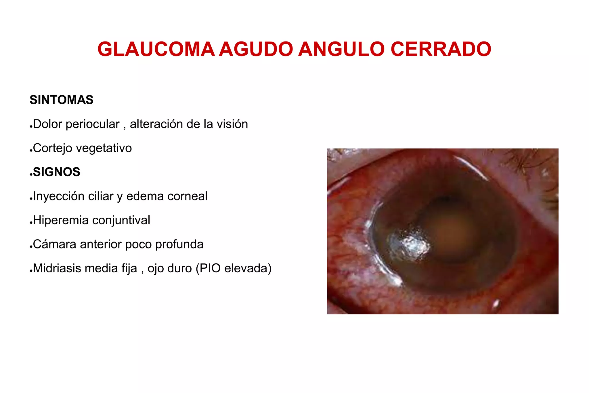 Patología oftalmológica en atención primaria.ppt