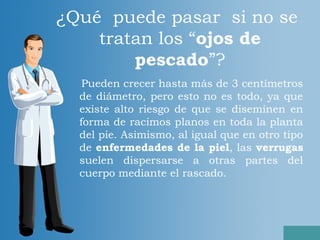 Ojos de pescado por descuido a los pies | PPT