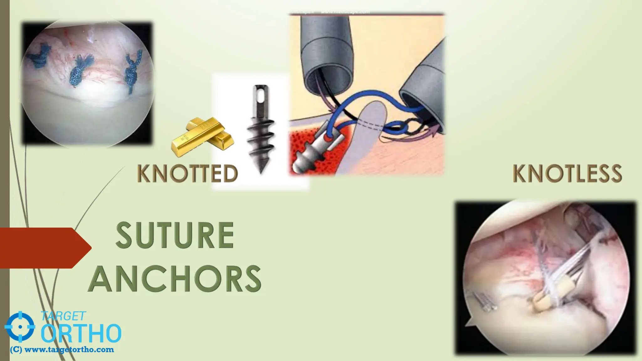 BASIC_ARTHROSCOPIC__INSTRUMENTATION.pptx