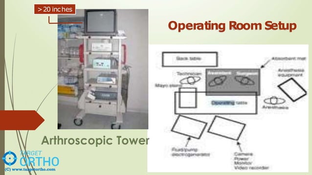 BASIC_ARTHROSCOPIC__INSTRUMENTATION.pptx